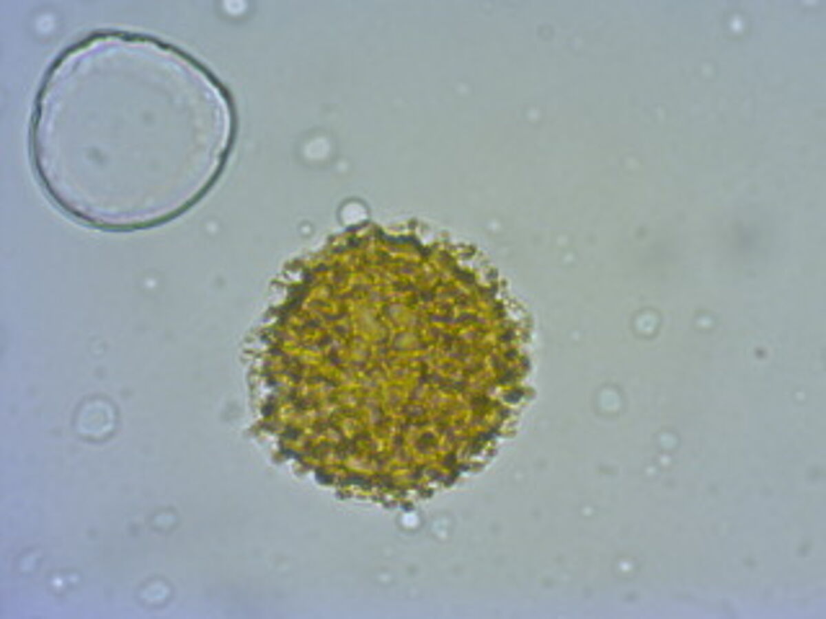 Subproject: Pollen identification - University of Greifswald